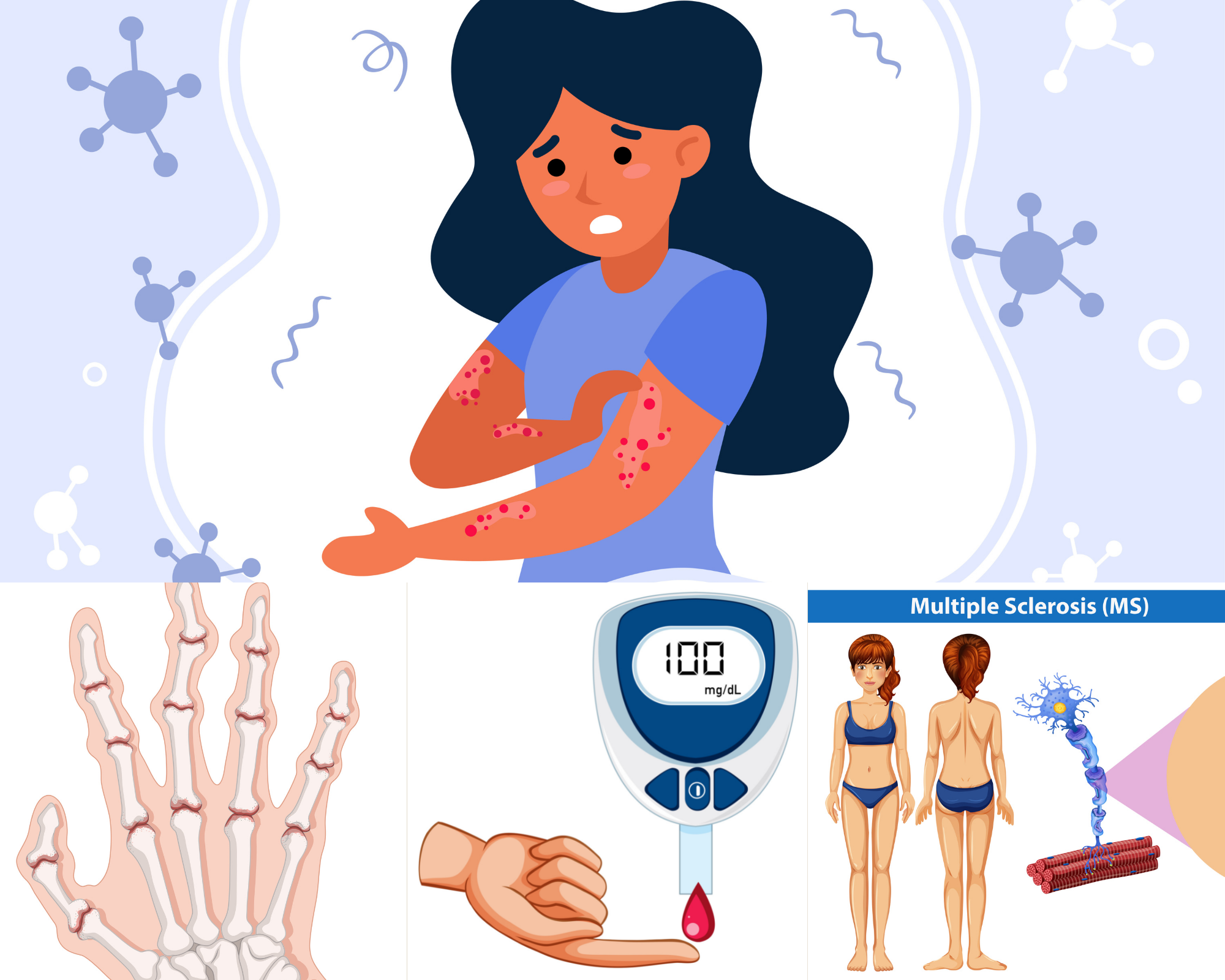 Immune System Disorders - 5 Common Types of Autoimmune diseases